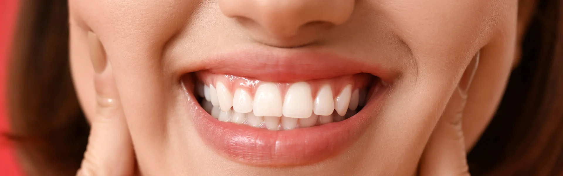 Transform Your Smile With Gum Line Alignment in Bromley - Smile 4 U